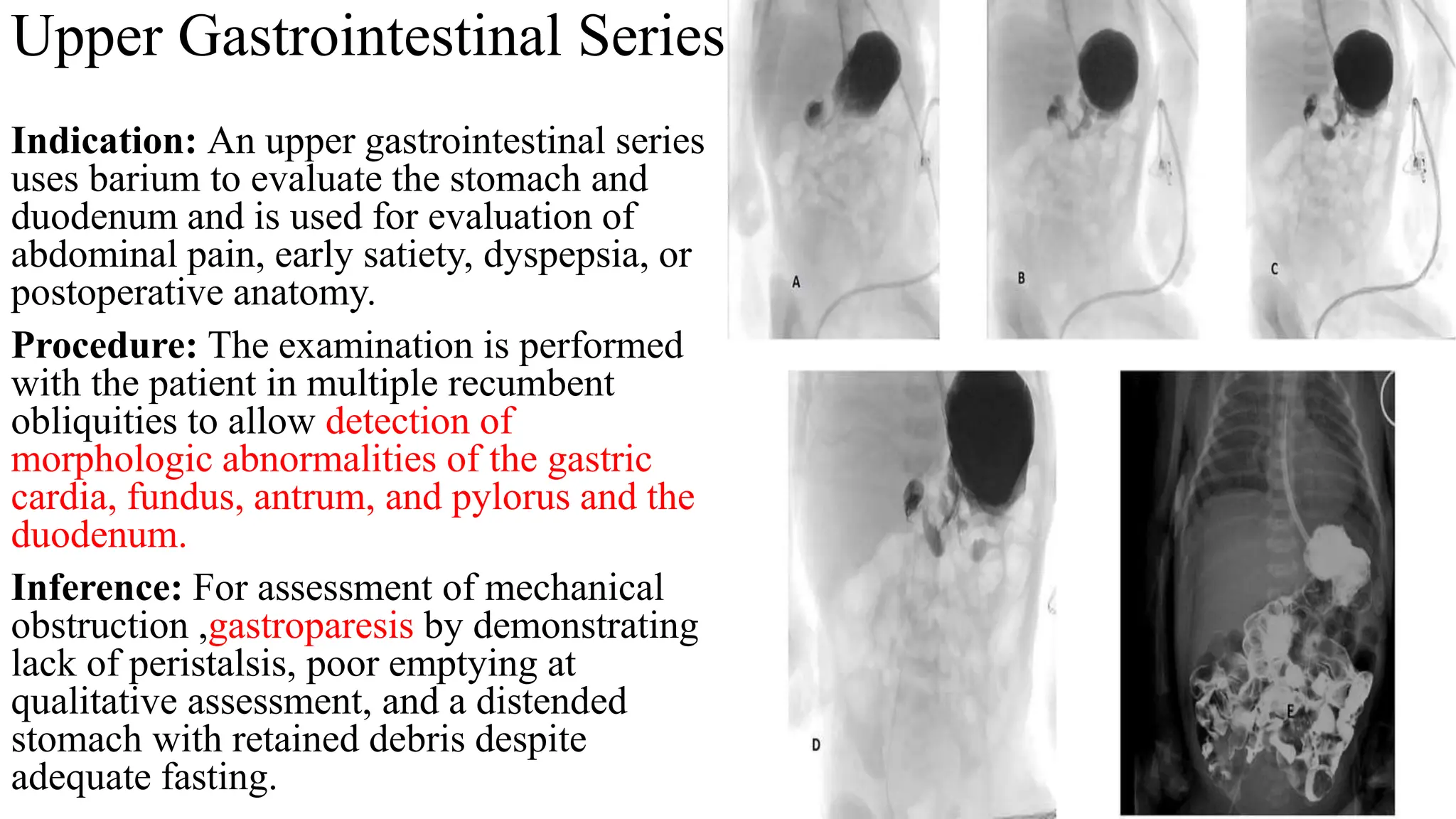 Imaging review Gastrointestinal motility disorders.pptx