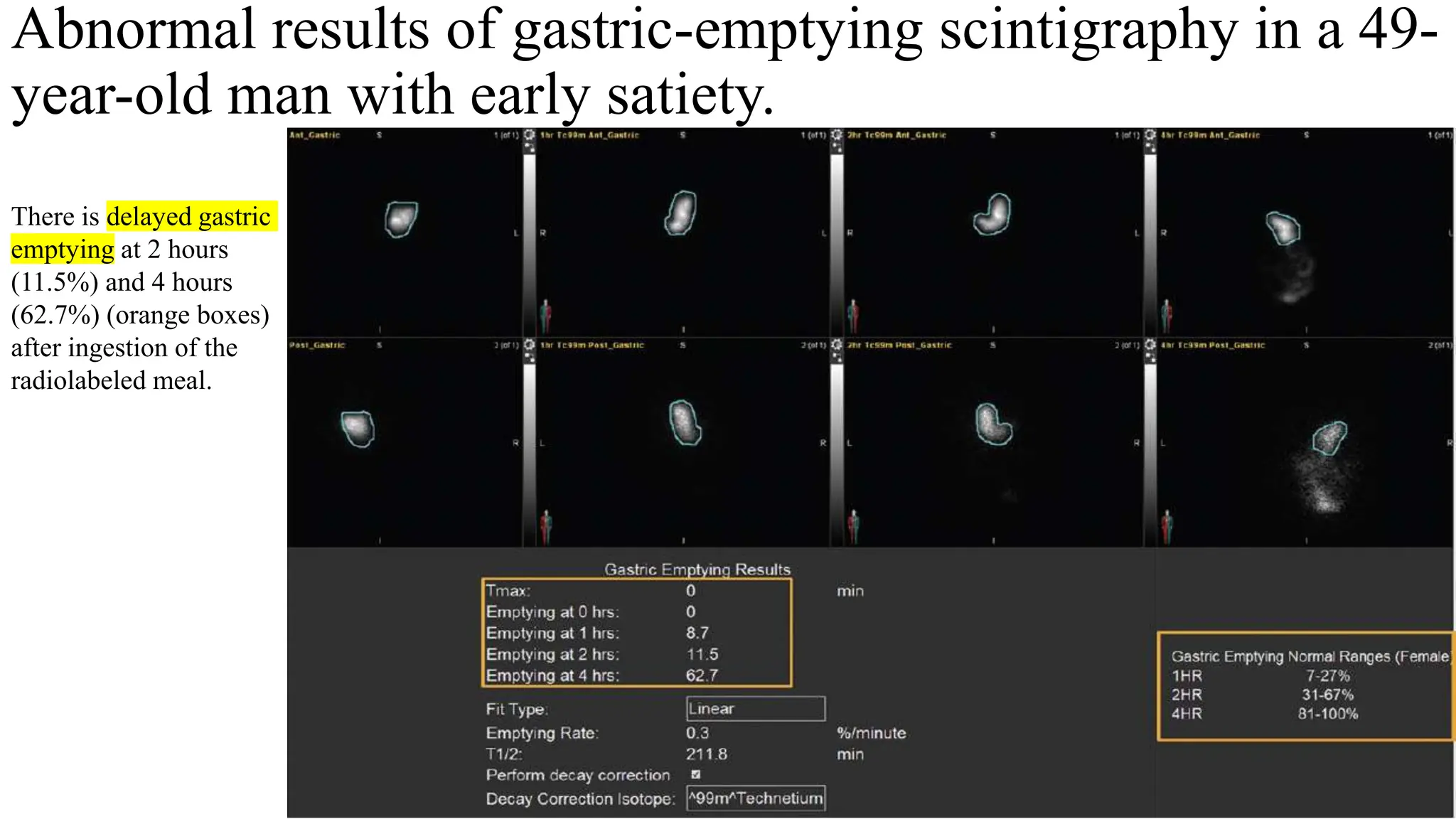 Imaging review Gastrointestinal motility disorders.pptx