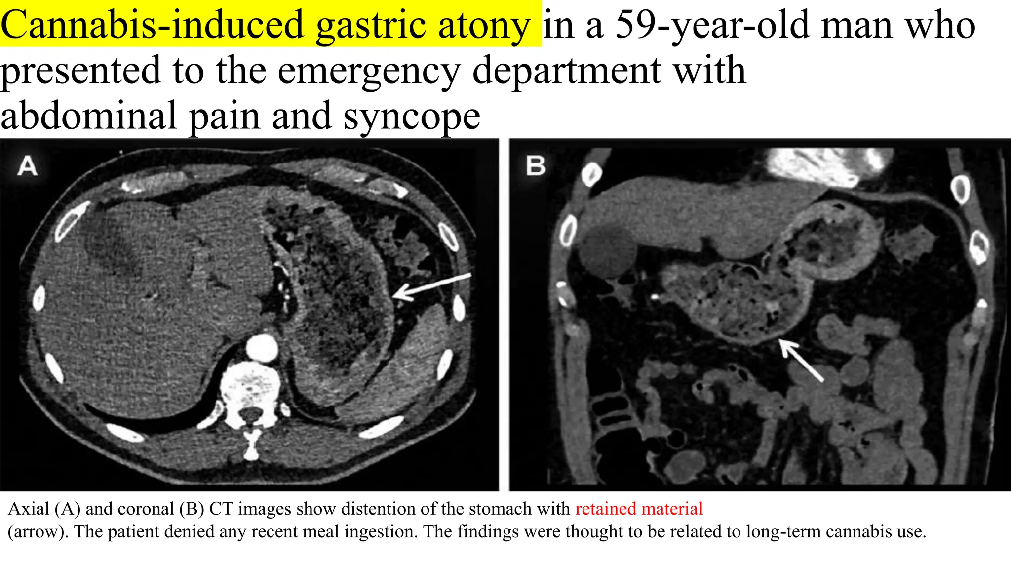 Imaging review Gastrointestinal motility disorders.pptx