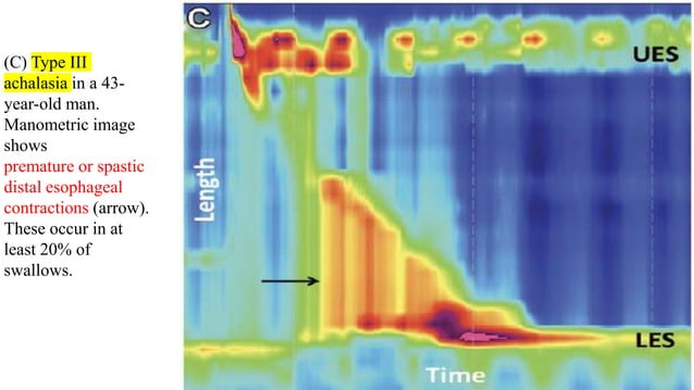Imaging review Gastrointestinal motility disorders.pptx