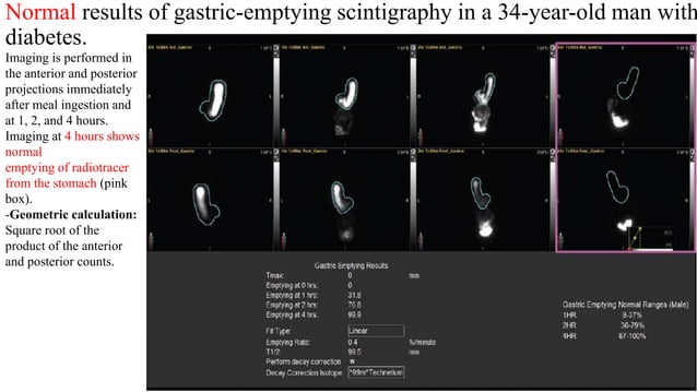 Imaging review Gastrointestinal motility disorders.pptx