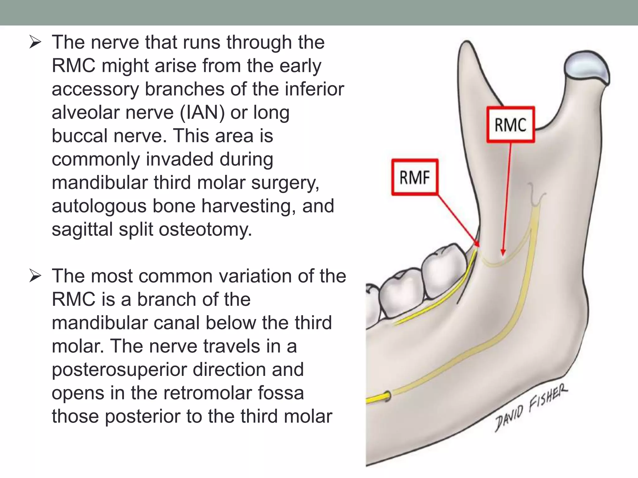 Impacted third molars | PPTX