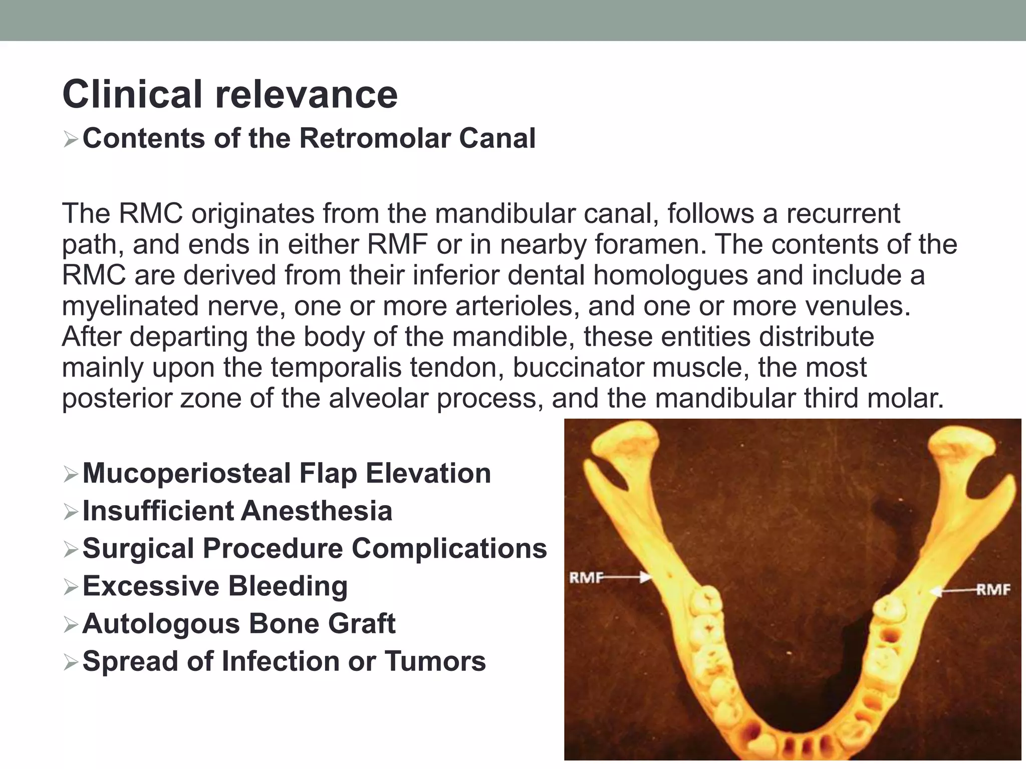 Impacted third molars | PPTX