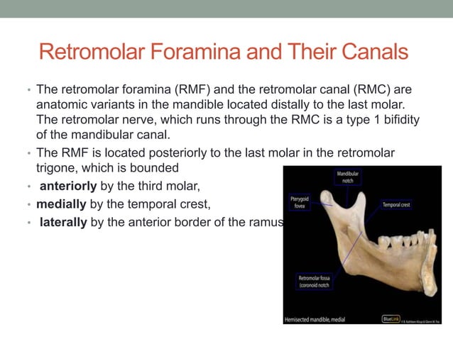 Impacted third molars | PPTX | Dental Health | Diseases and Conditions