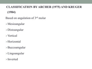 Impacted third molars | PPTX