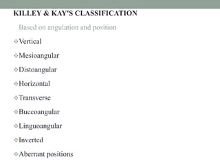 Impacted third molars | PPTX