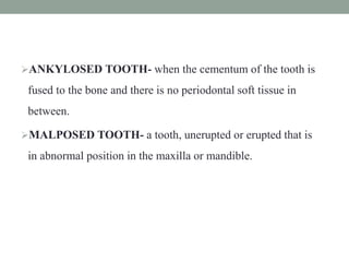 Impacted third molars | PPTX