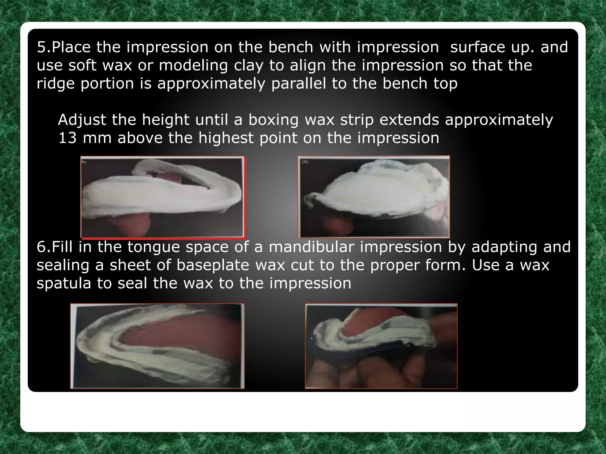 Final impression boxing and pouring | PPTX