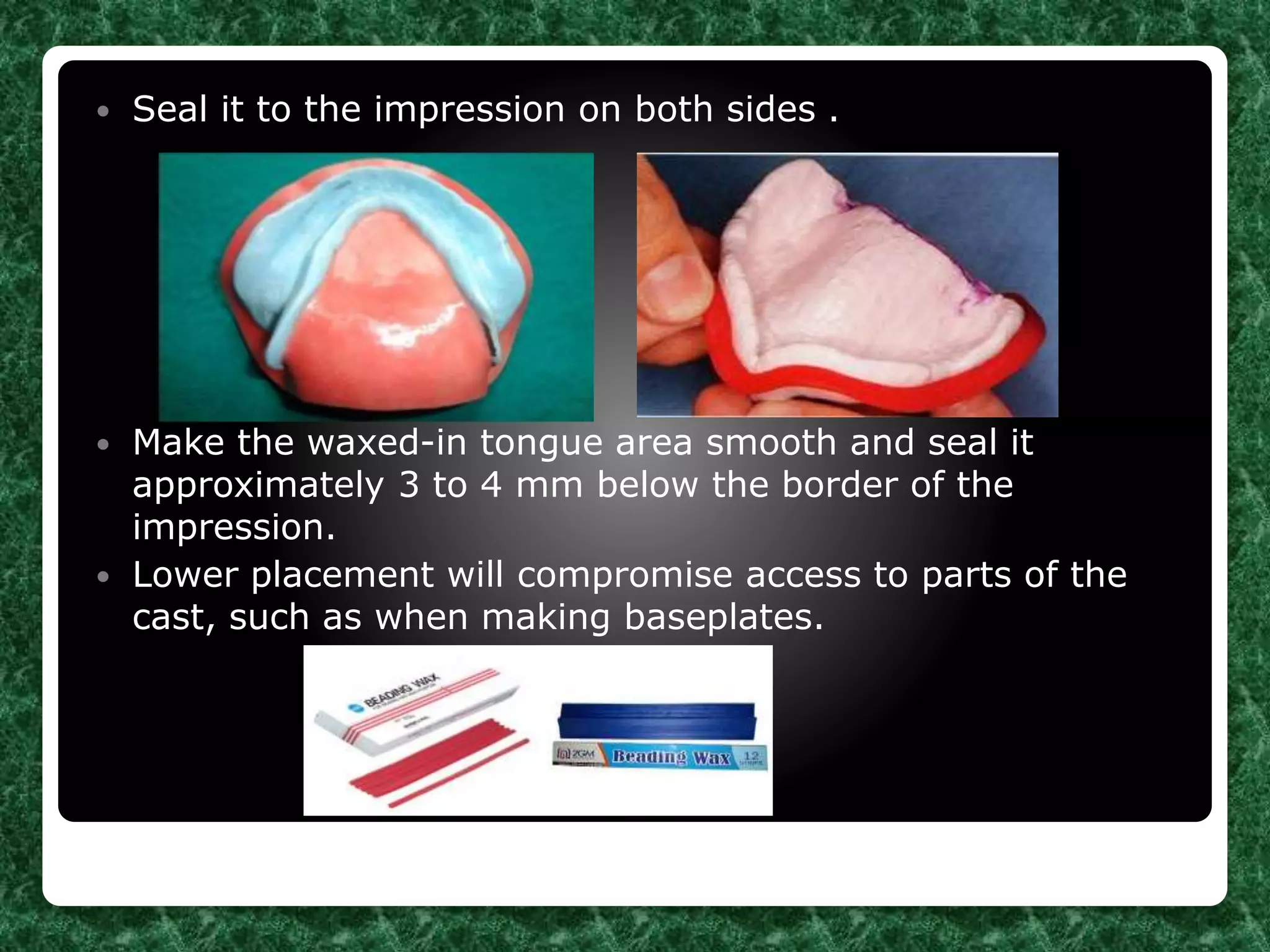 Final impression boxing and pouring | PPTX