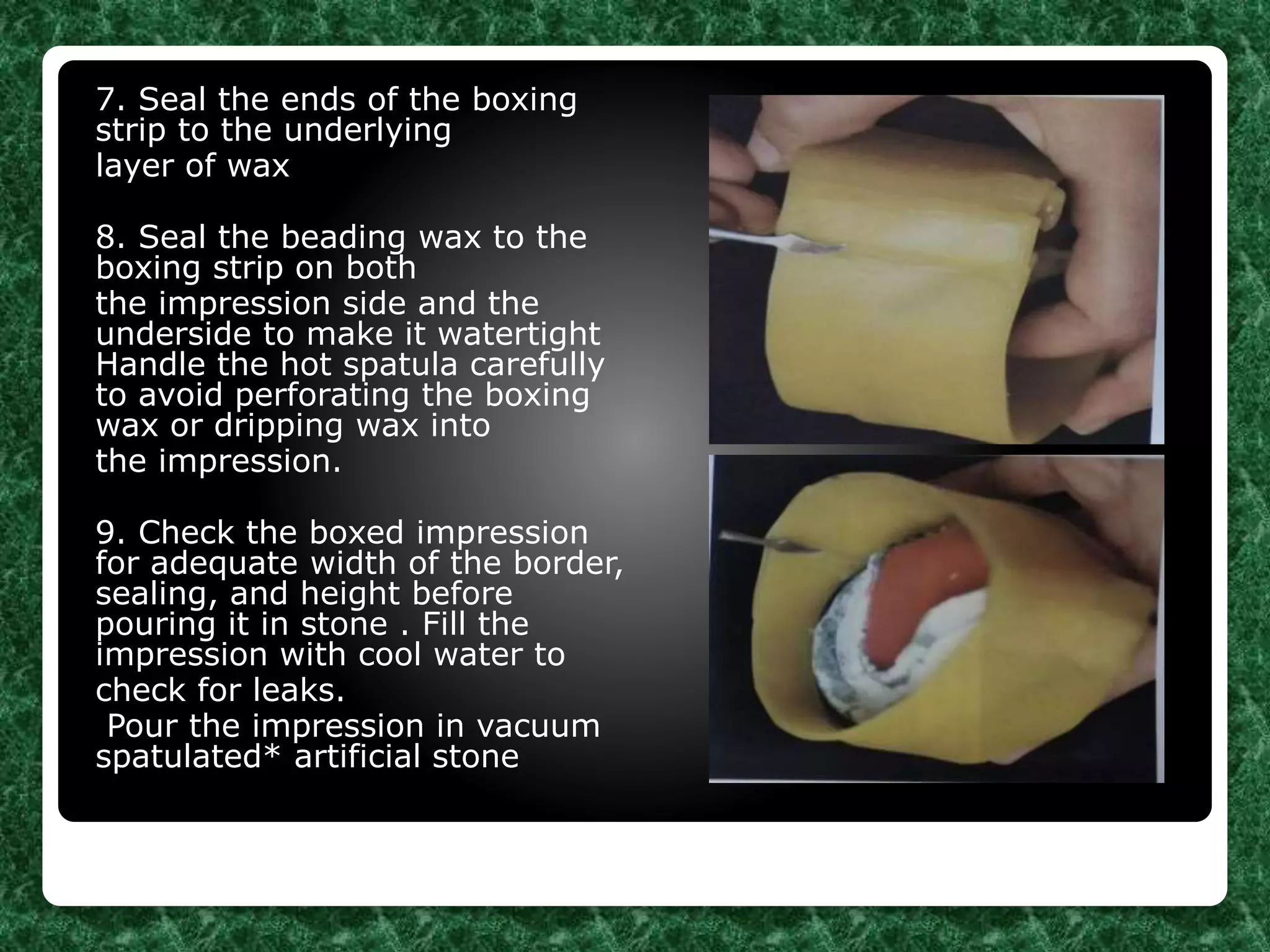 Final impression boxing and pouring | PPTX