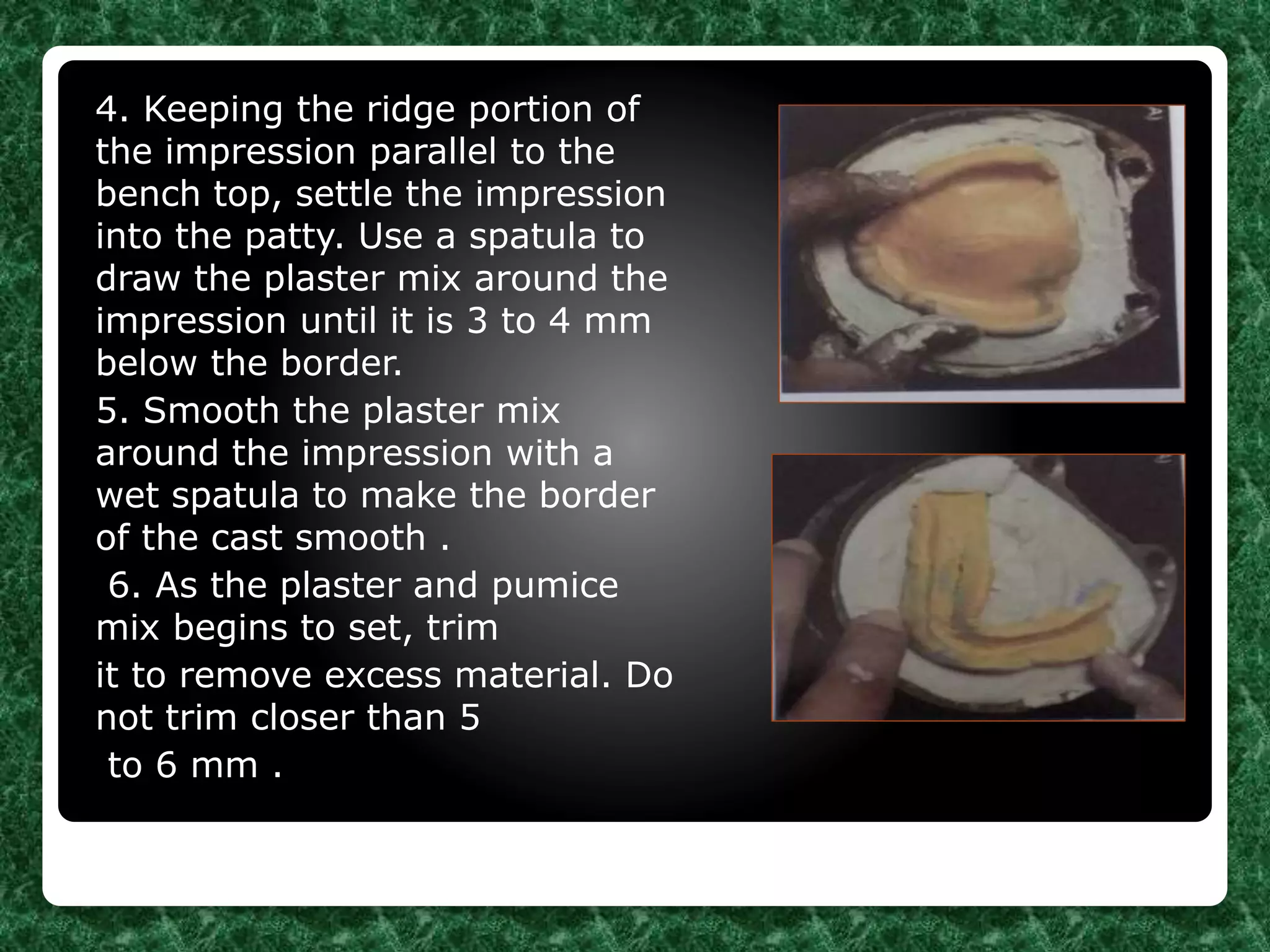 Final impression boxing and pouring | PPTX