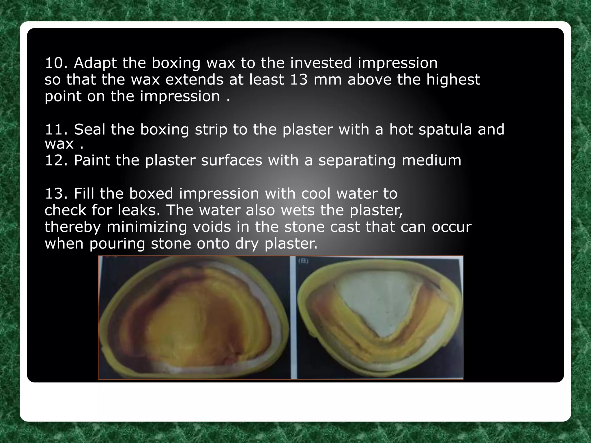Final impression boxing and pouring | PPTX