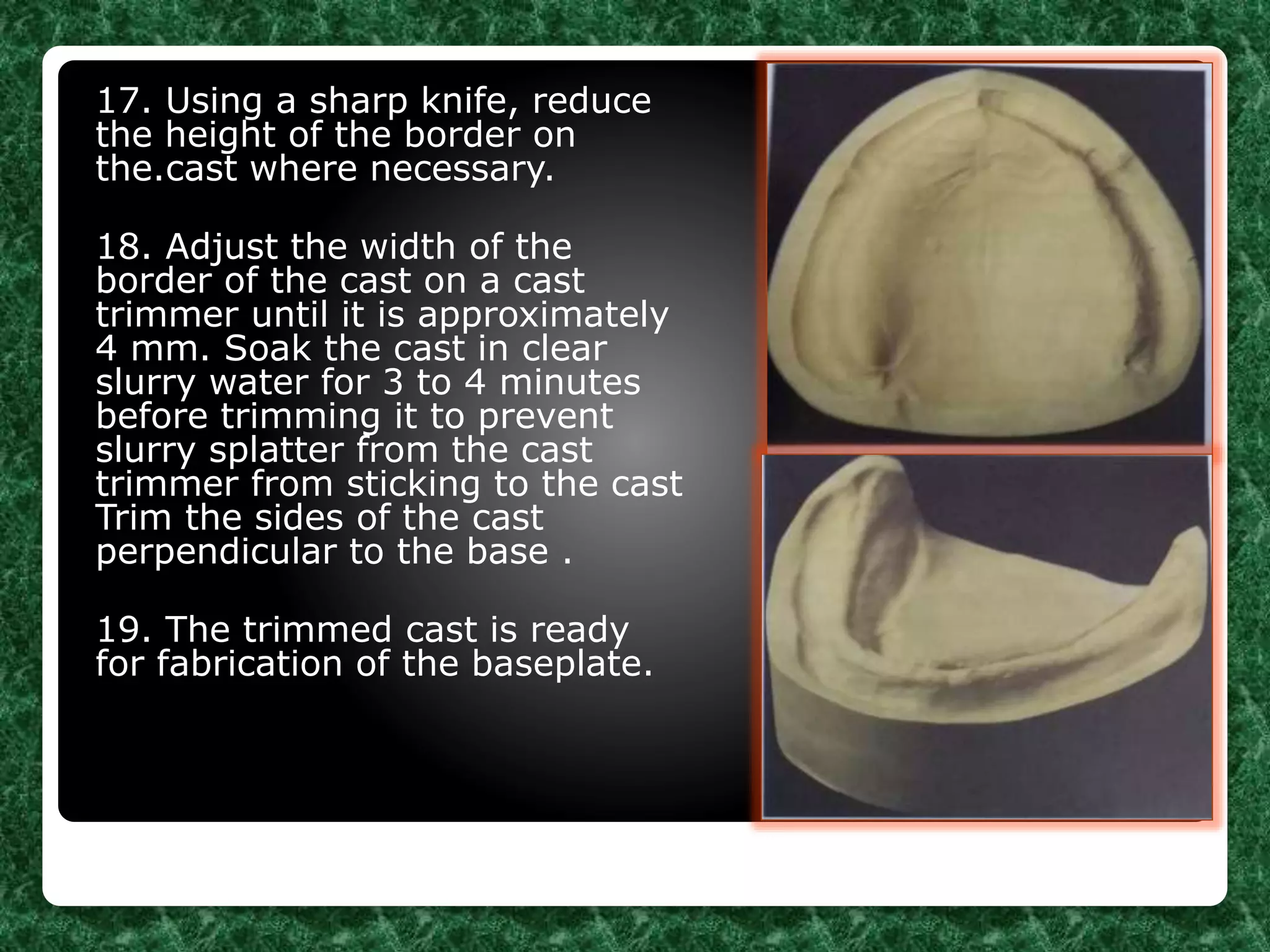 Final impression boxing and pouring | PPTX