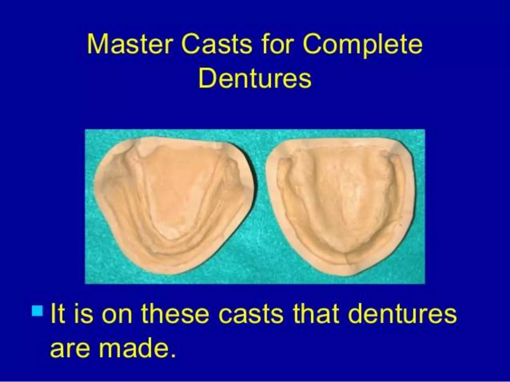 Final impression boxing and pouring | PPTX