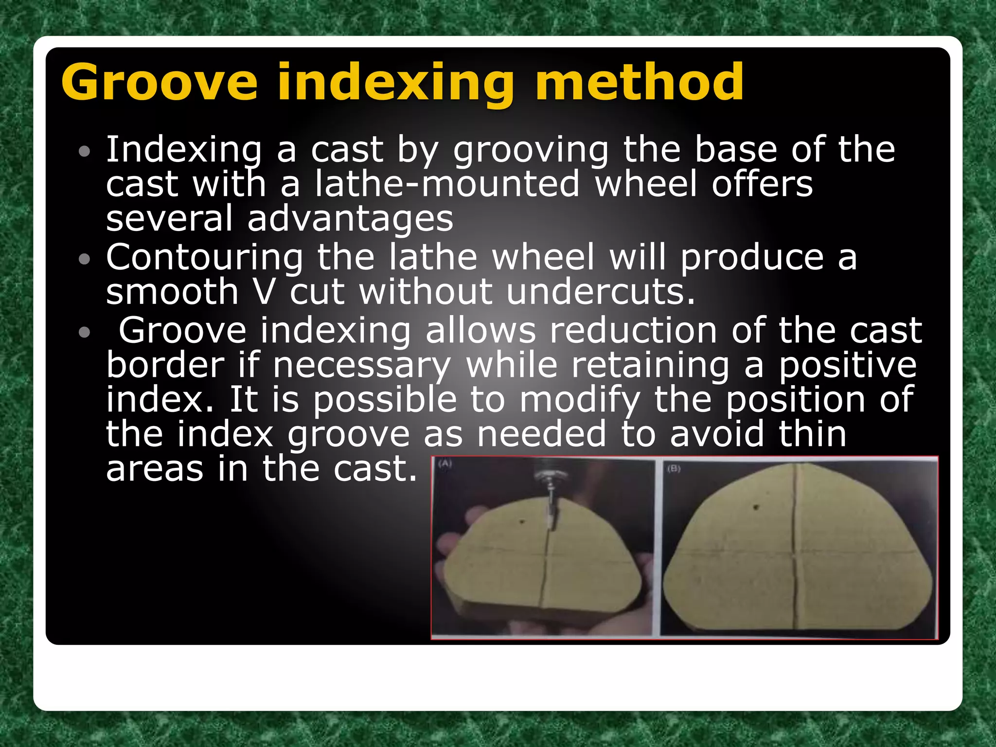 Final impression boxing and pouring | PPTX