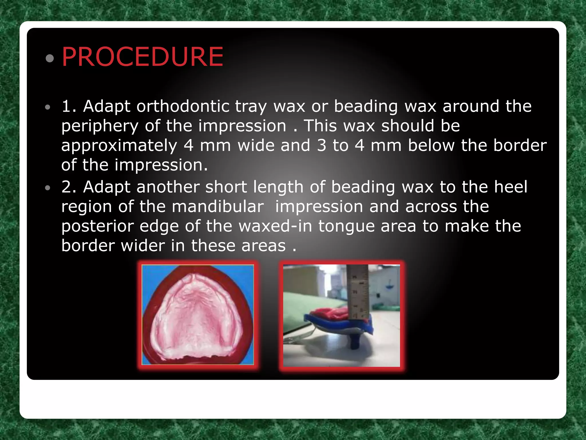 Final impression boxing and pouring | PPTX