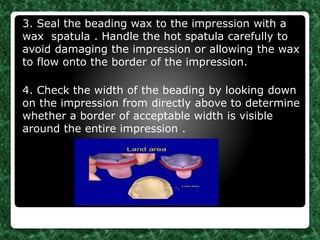 Final impression boxing and pouring | PPTX