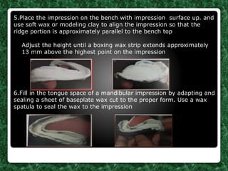 Final impression boxing and pouring | PPTX