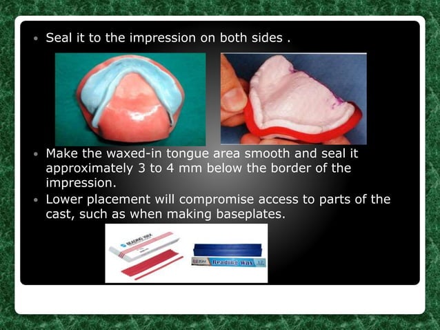 Final impression boxing and pouring | PPTX