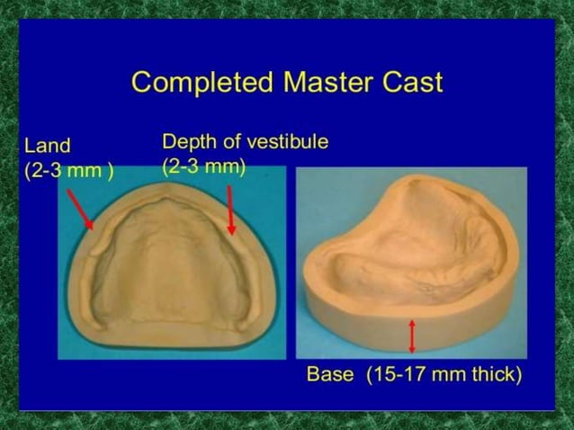 Final impression boxing and pouring | PPTX