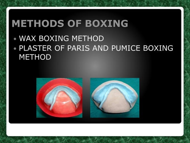 Final impression boxing and pouring | PPTX