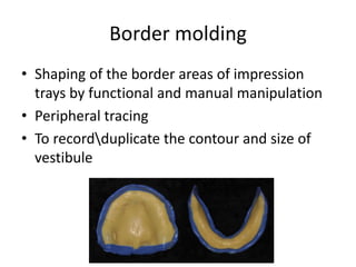 Final impression CD | PPT
