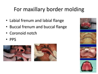 Final impression CD | PPT