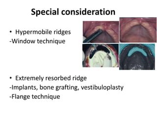 Final impression CD | PPT