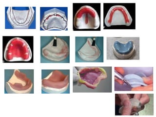 Final impression CD | PPT