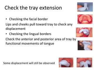 Final impression CD | PPT