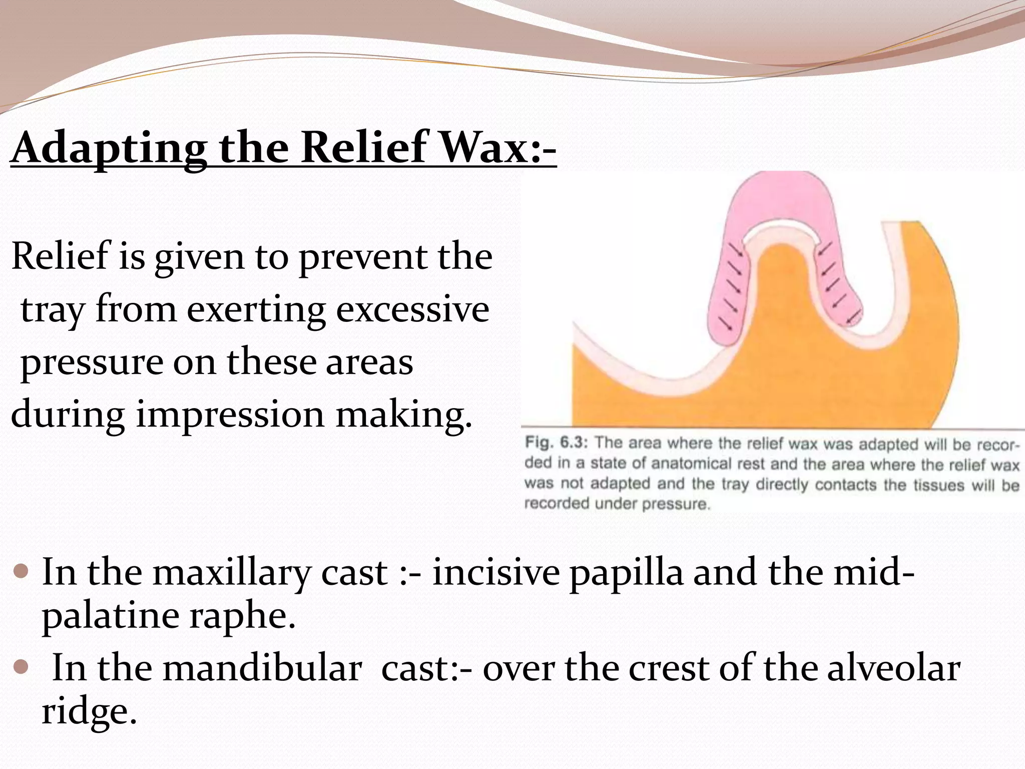 Secondary impression in complete denture CD | PPTX