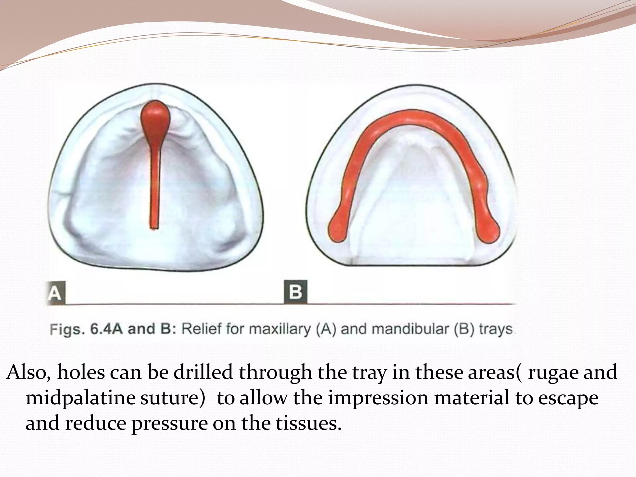 Secondary impression in complete denture CD | PPTX