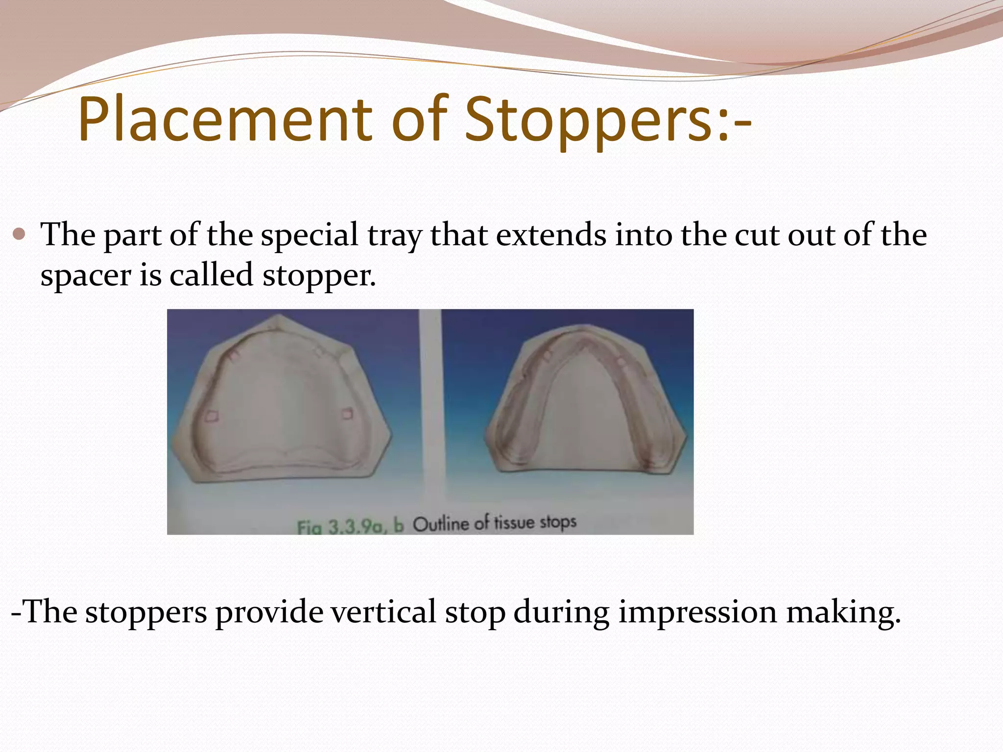 Secondary impression in complete denture CD | PPTX