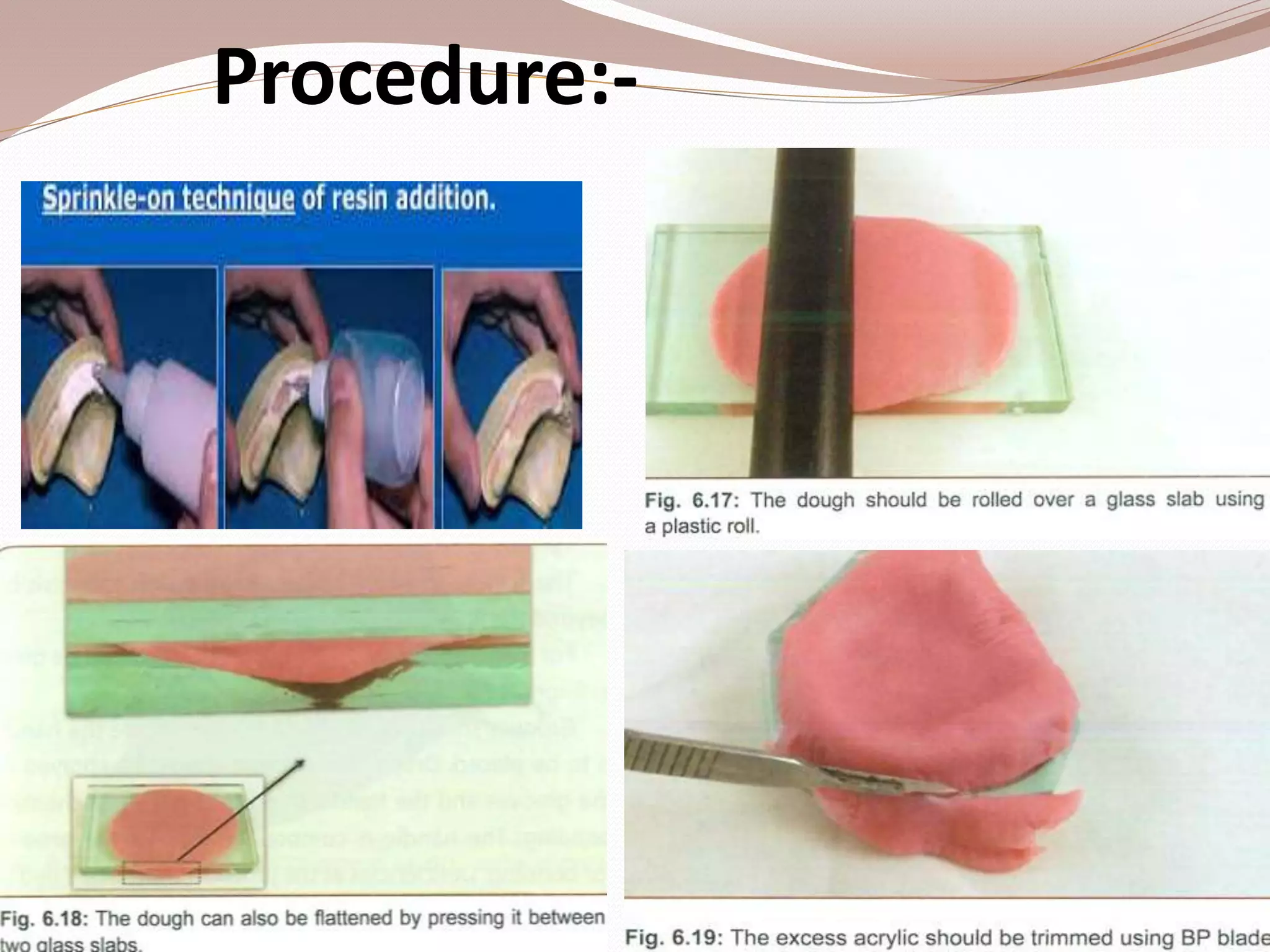 Secondary impression in complete denture CD | PPTX