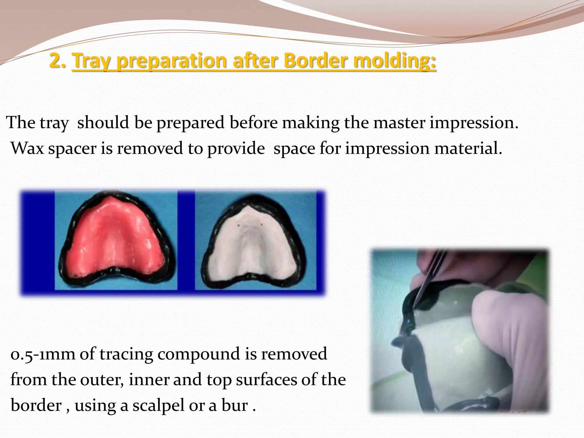 Secondary impression in complete denture CD | PPTX | Oral care ...