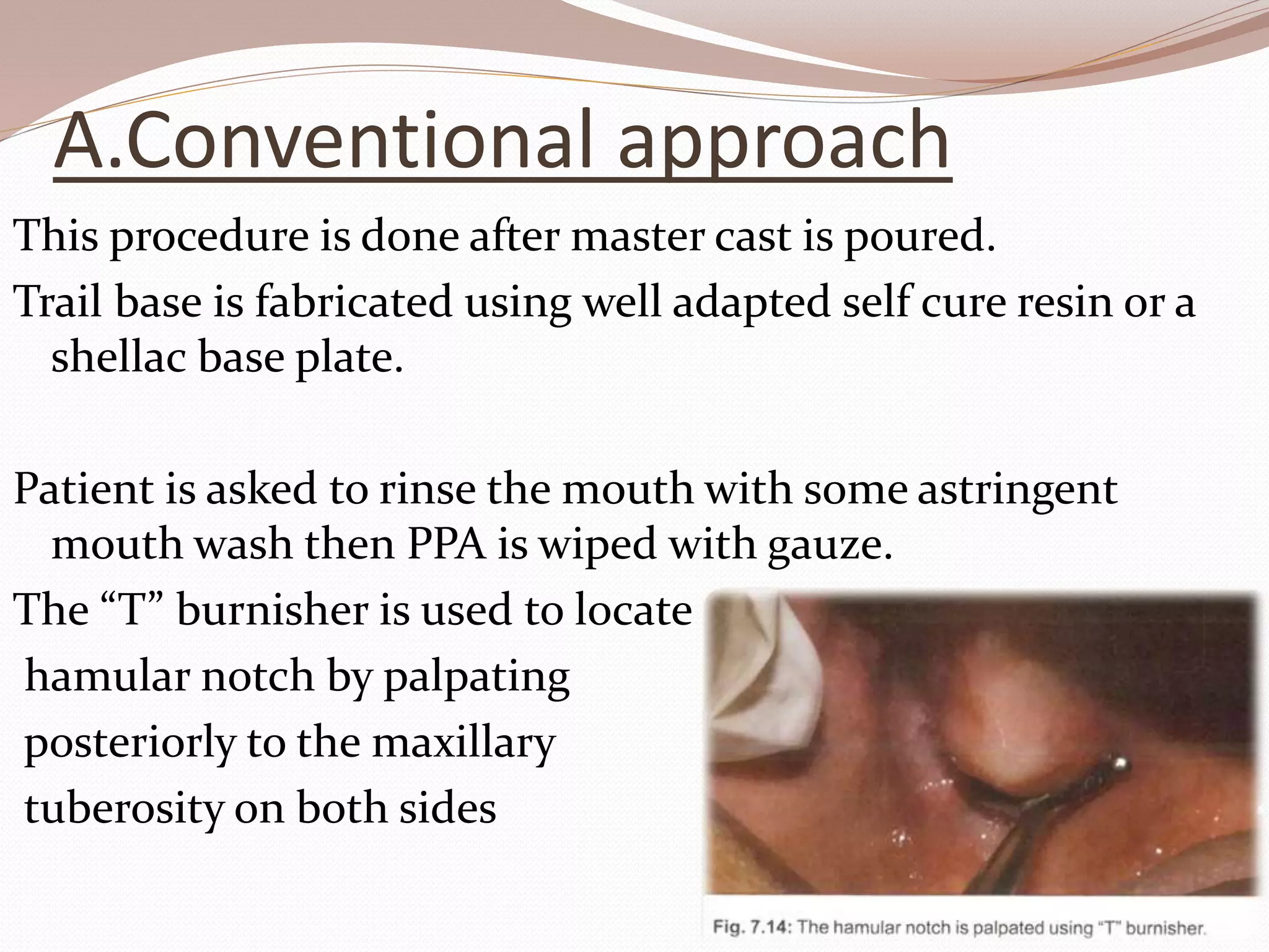 Secondary impression in complete denture CD | PPTX | Oral care ...