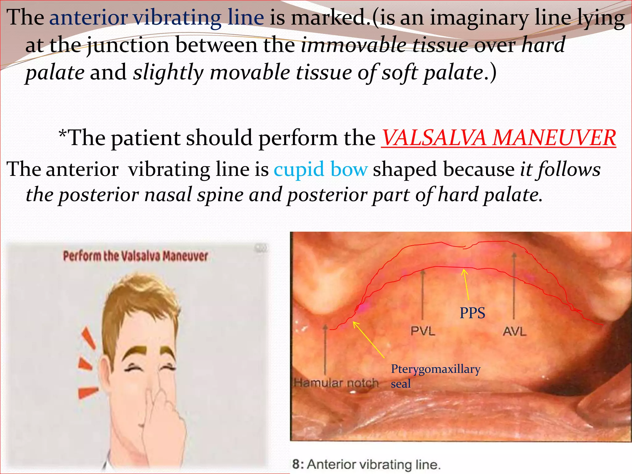 Secondary impression in complete denture CD | PPTX