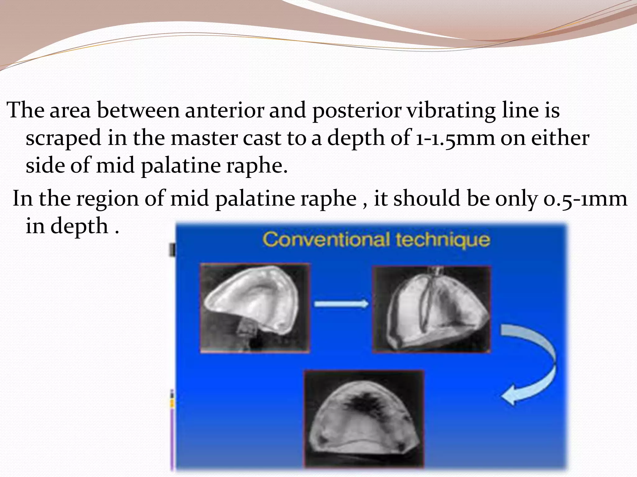 Secondary impression in complete denture CD | PPTX | Oral care ...