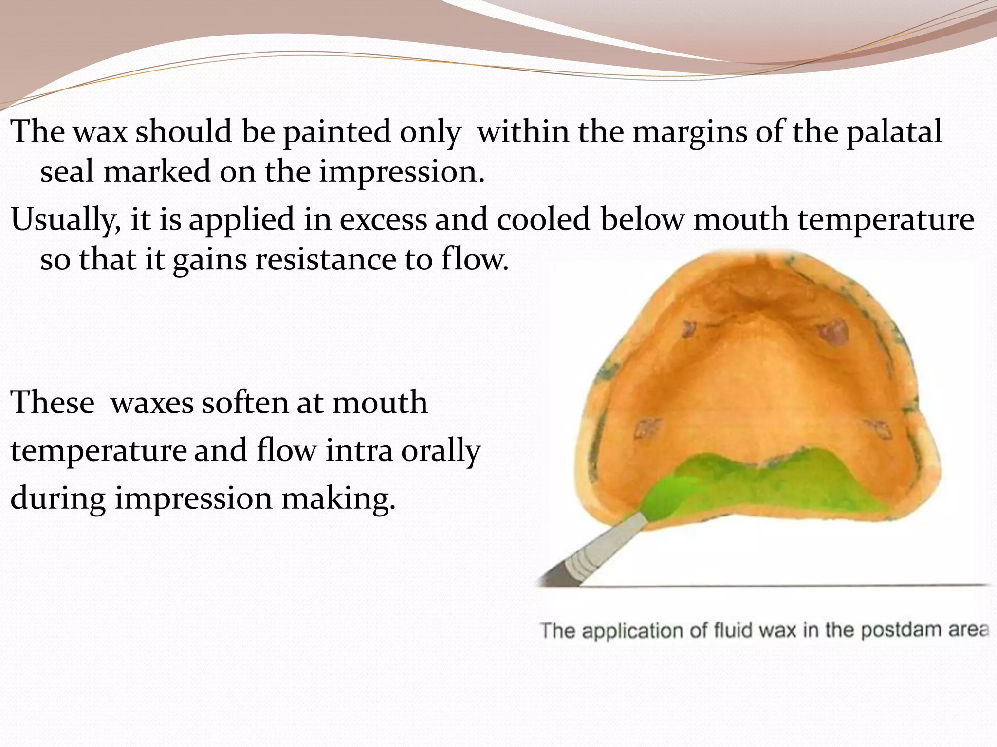 Secondary impression in complete denture CD | PPTX