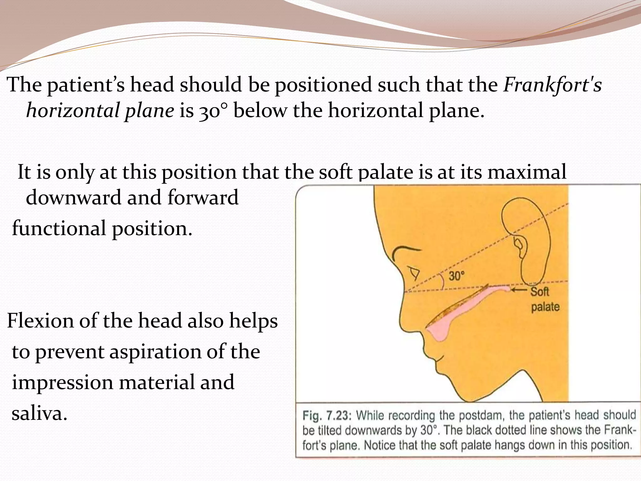 Secondary impression in complete denture CD | PPTX