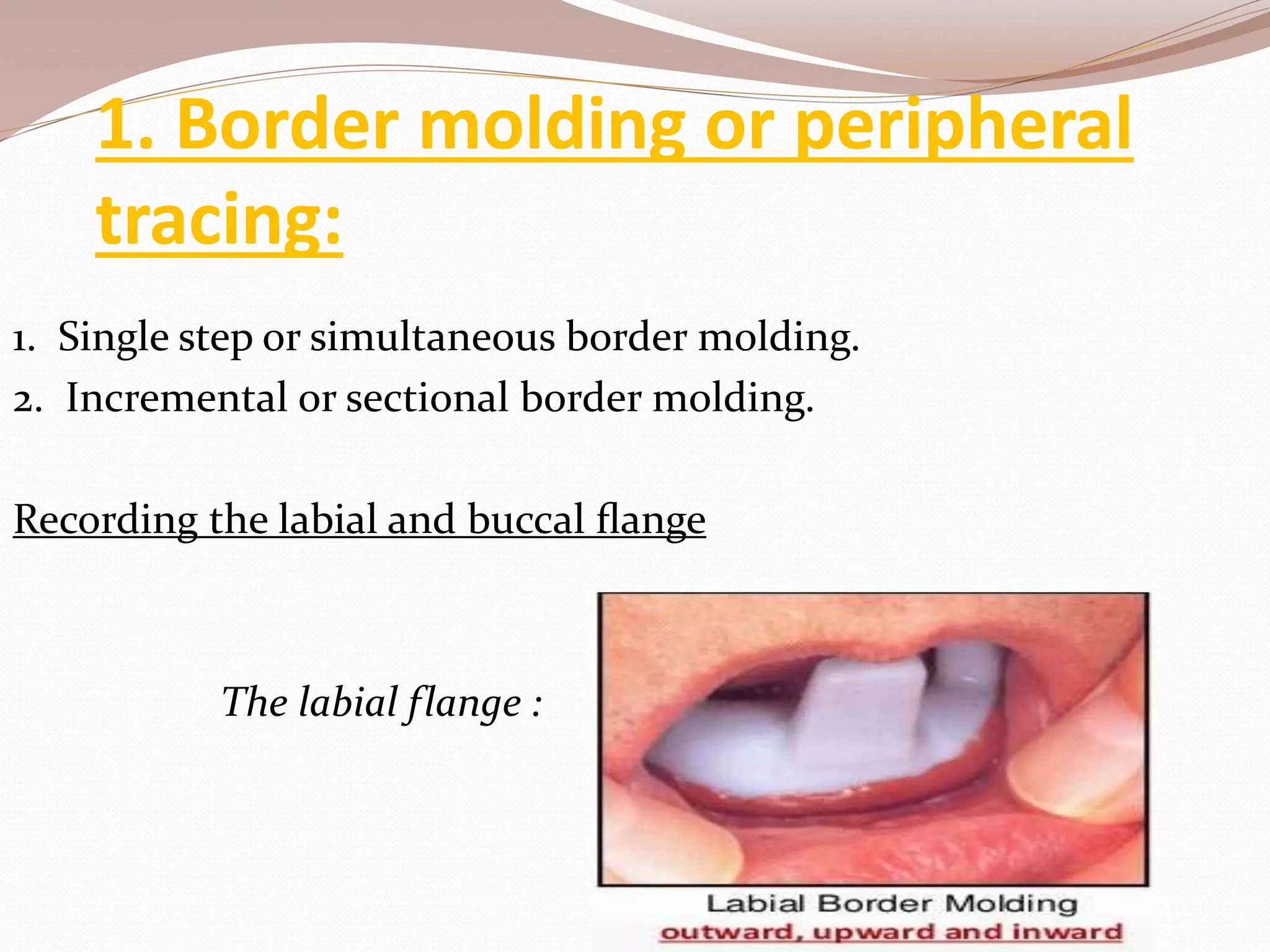 Secondary impression in complete denture CD | PPTX