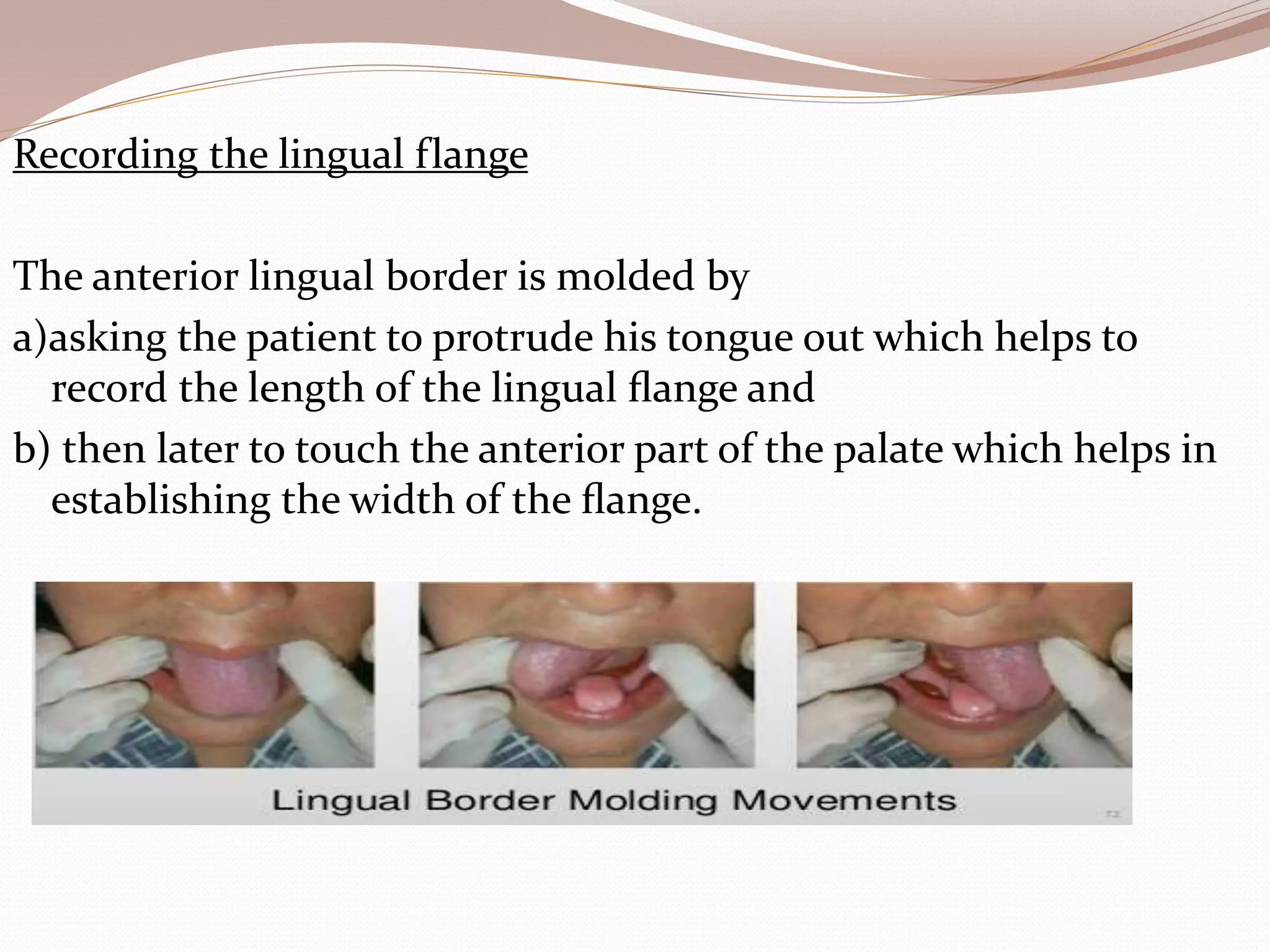 Secondary impression in complete denture CD | PPTX