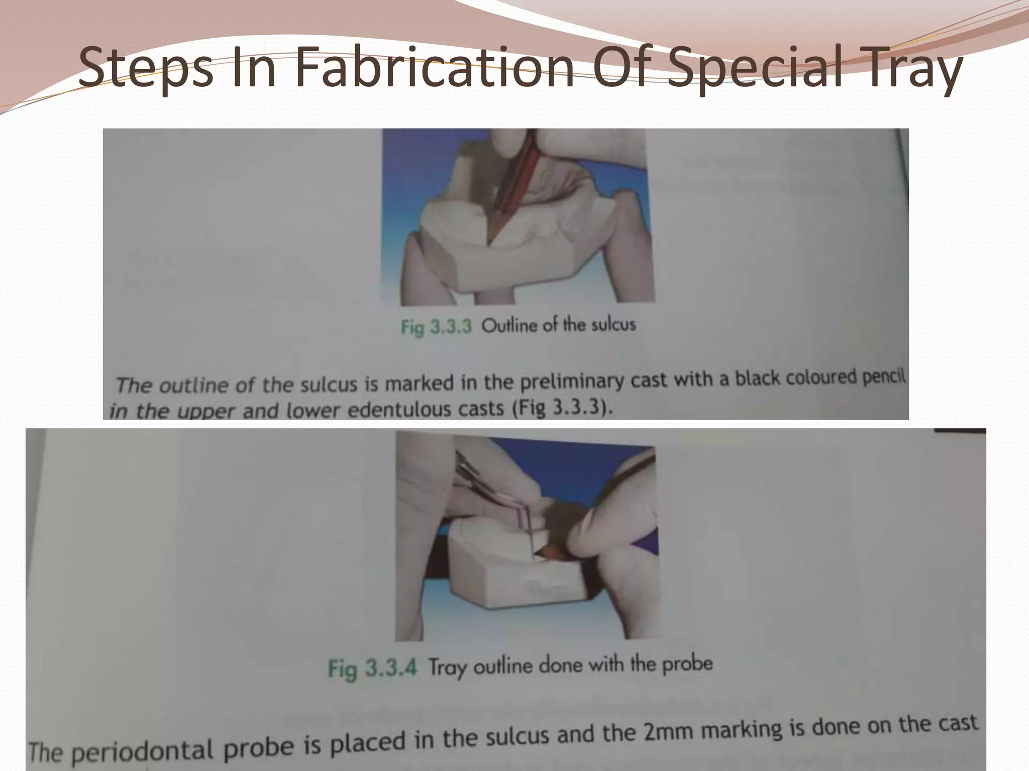 Secondary impression in complete denture CD | PPTX