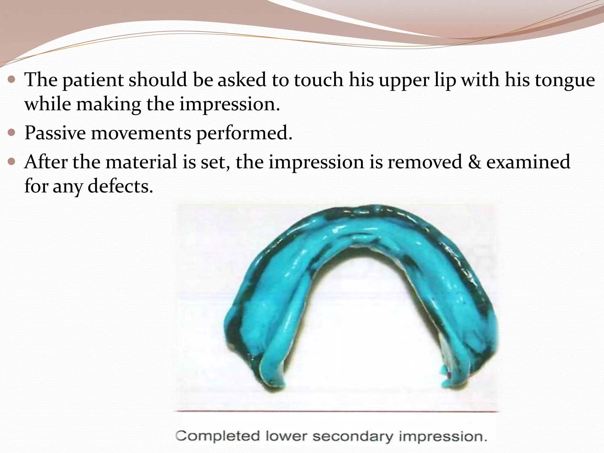 Secondary impression in complete denture CD | PPTX