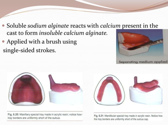 Secondary impression in complete denture CD | PPTX | Oral care ...