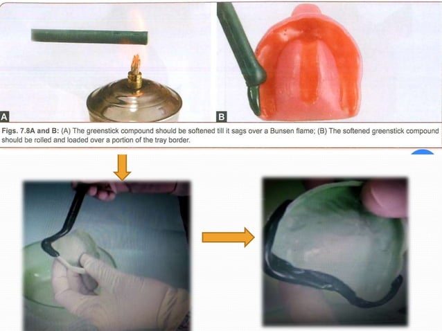 Secondary impression in complete denture CD | PPTX | Oral care ...