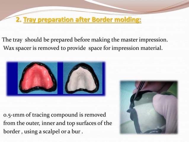 Secondary impression in complete denture CD | PPTX | Oral care ...