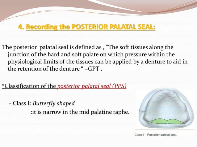 Secondary impression in complete denture CD | PPTX | Oral care ...
