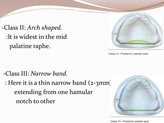 Secondary impression in complete denture CD | PPTX | Oral care ...