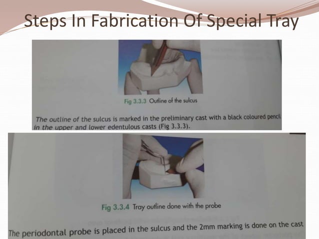 Secondary impression in complete denture CD | PPTX | Oral care ...